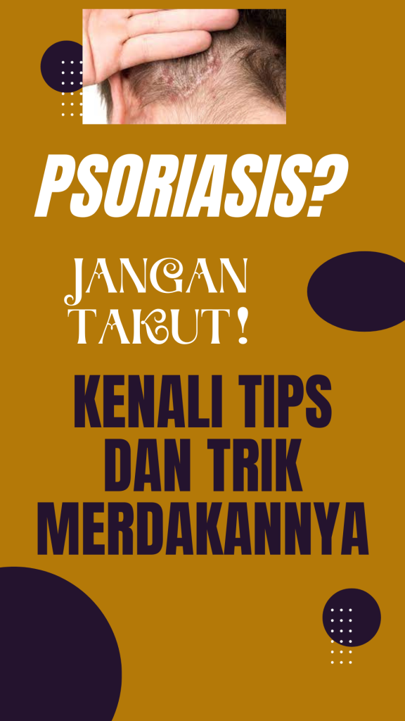 Kenali gejala psoriasis, faktor-faktor penyebab psoriasis dan cara meredakan psoriasis pada ...